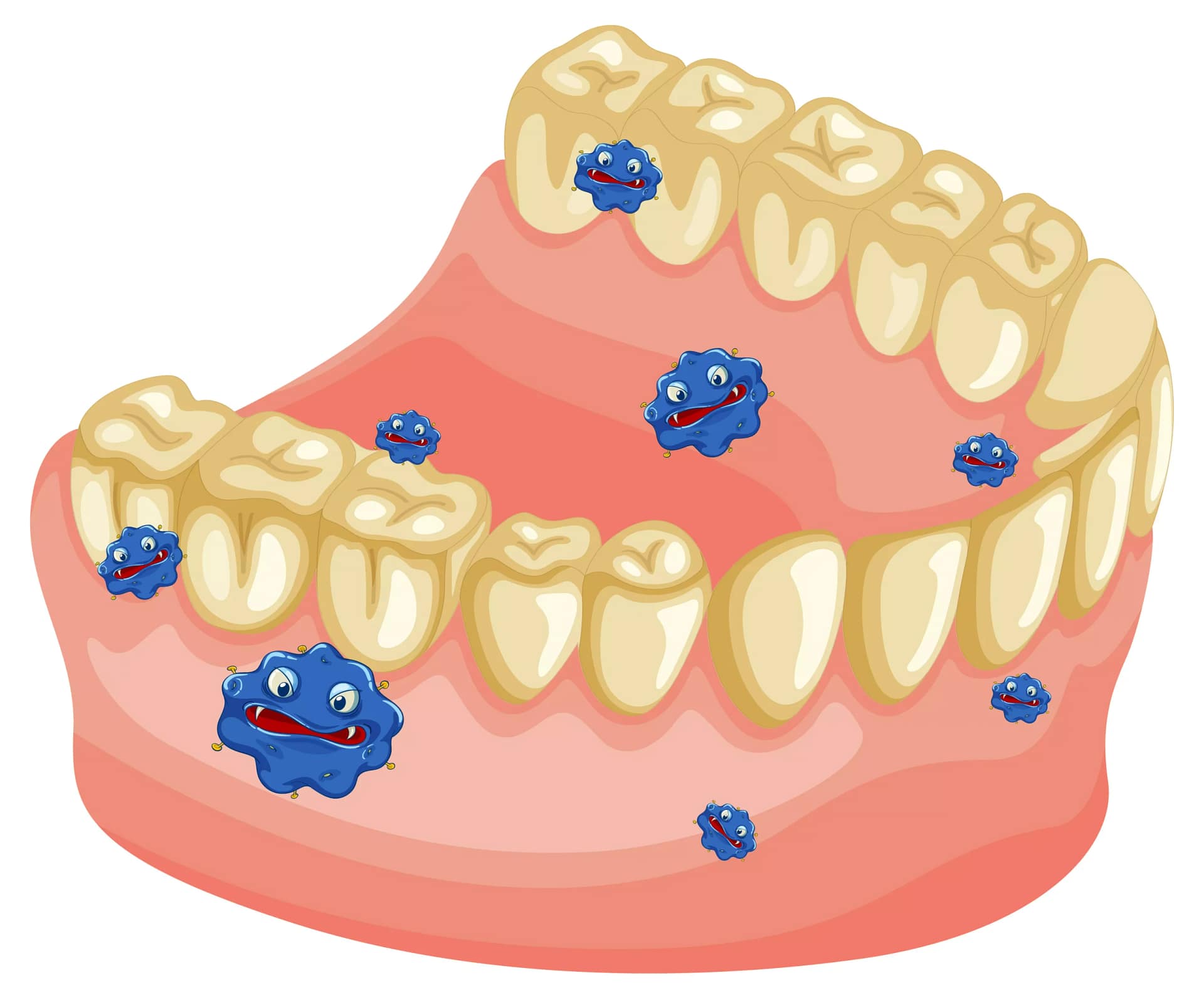 Placa bacteriana 🦠 Causas, consecuencias y tratamientos